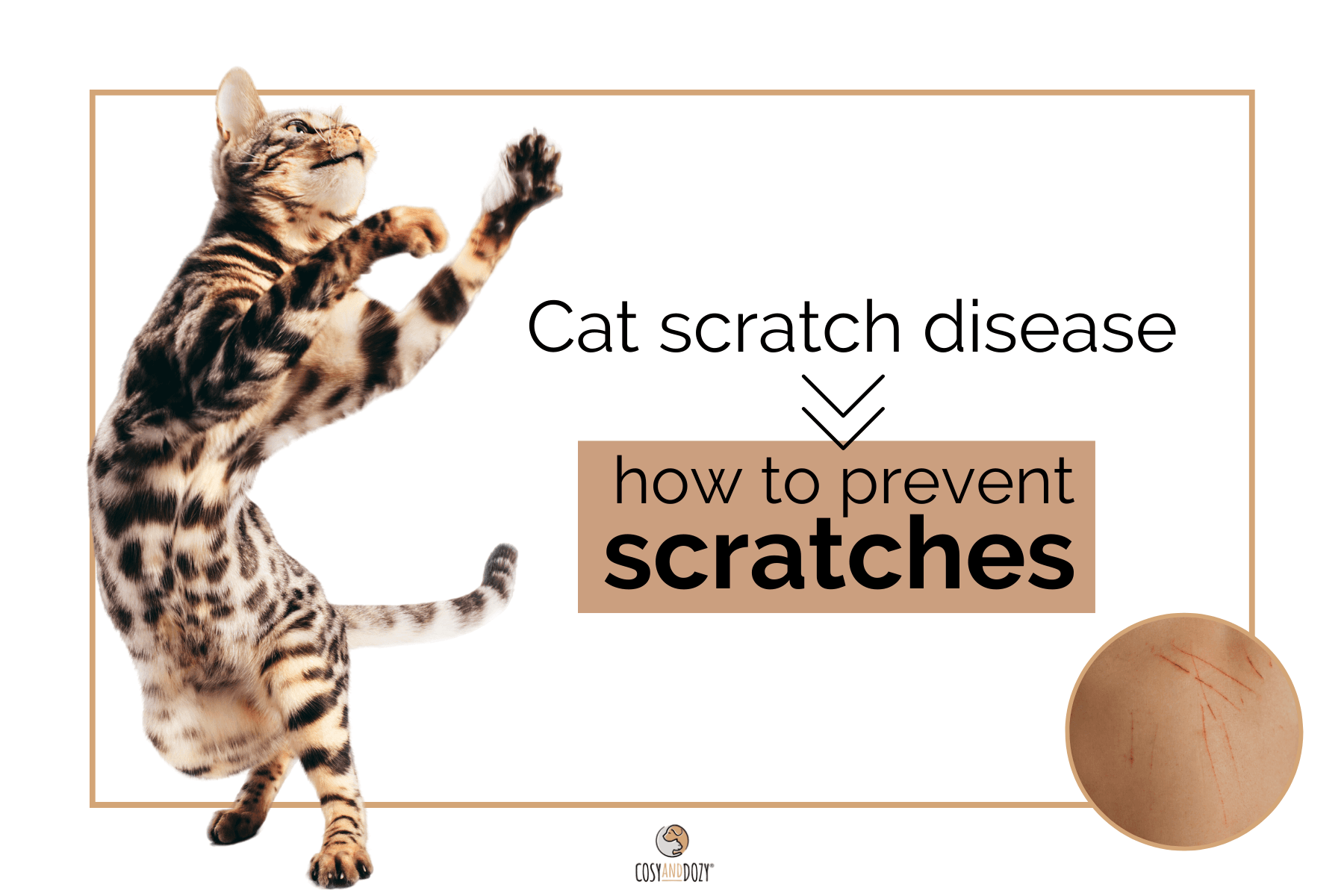 Cat scratch disease - causes, symptoms, treatment and prevention | COSY ...